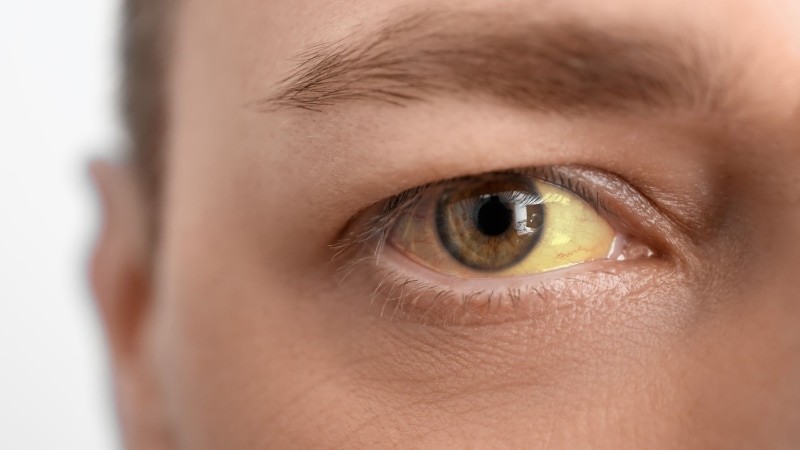 Gele ogen – wat is de moeite waard om te weten? | efpa.be